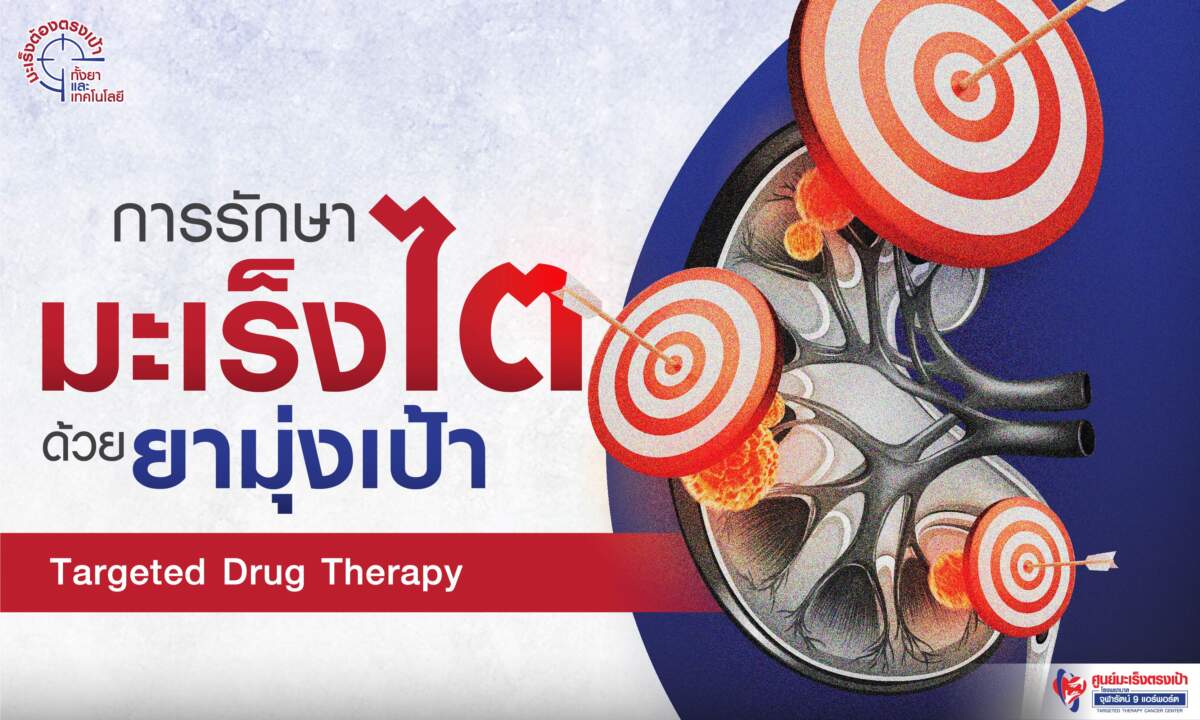 การรักษามะเร็งไตด้วยยามุ่งเป้า (Targeted Drug Therapy) - ศูนย์มะเร็งตรงเป้า